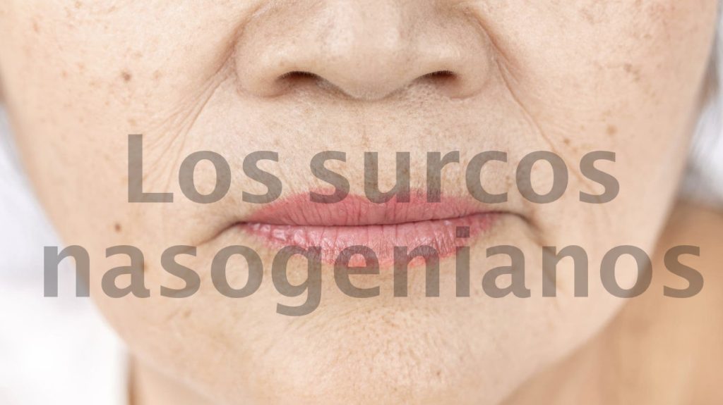 Surcos nasogenianos : Tratamientos para eliminarlos